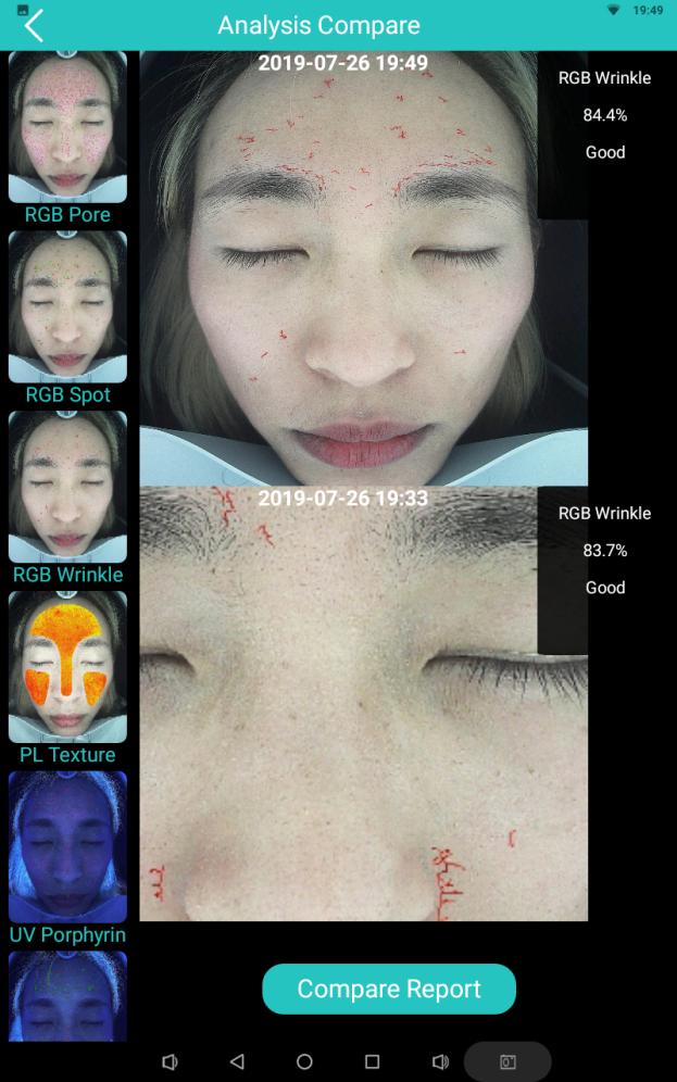 DermaVision Plus Skin Analysis Machine - Fotromed