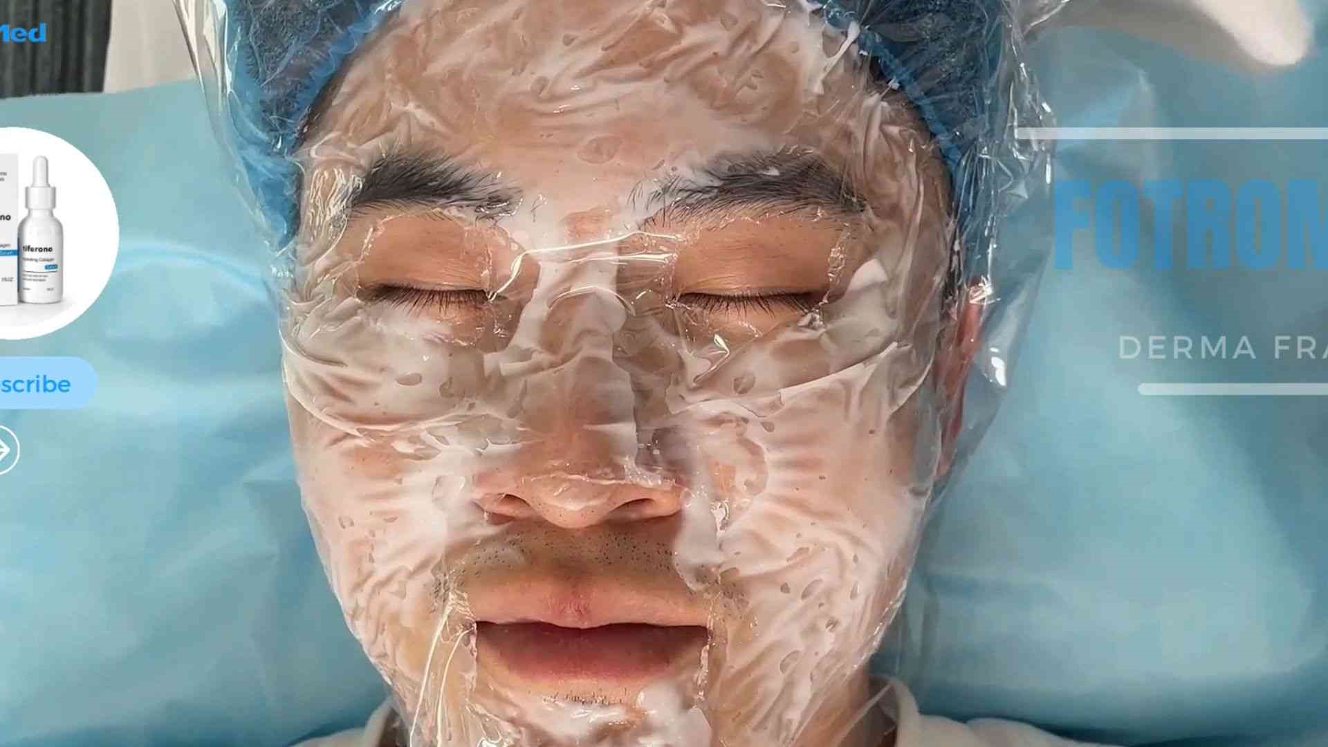 How to Use Microneedling RF Machine? - Fotromed