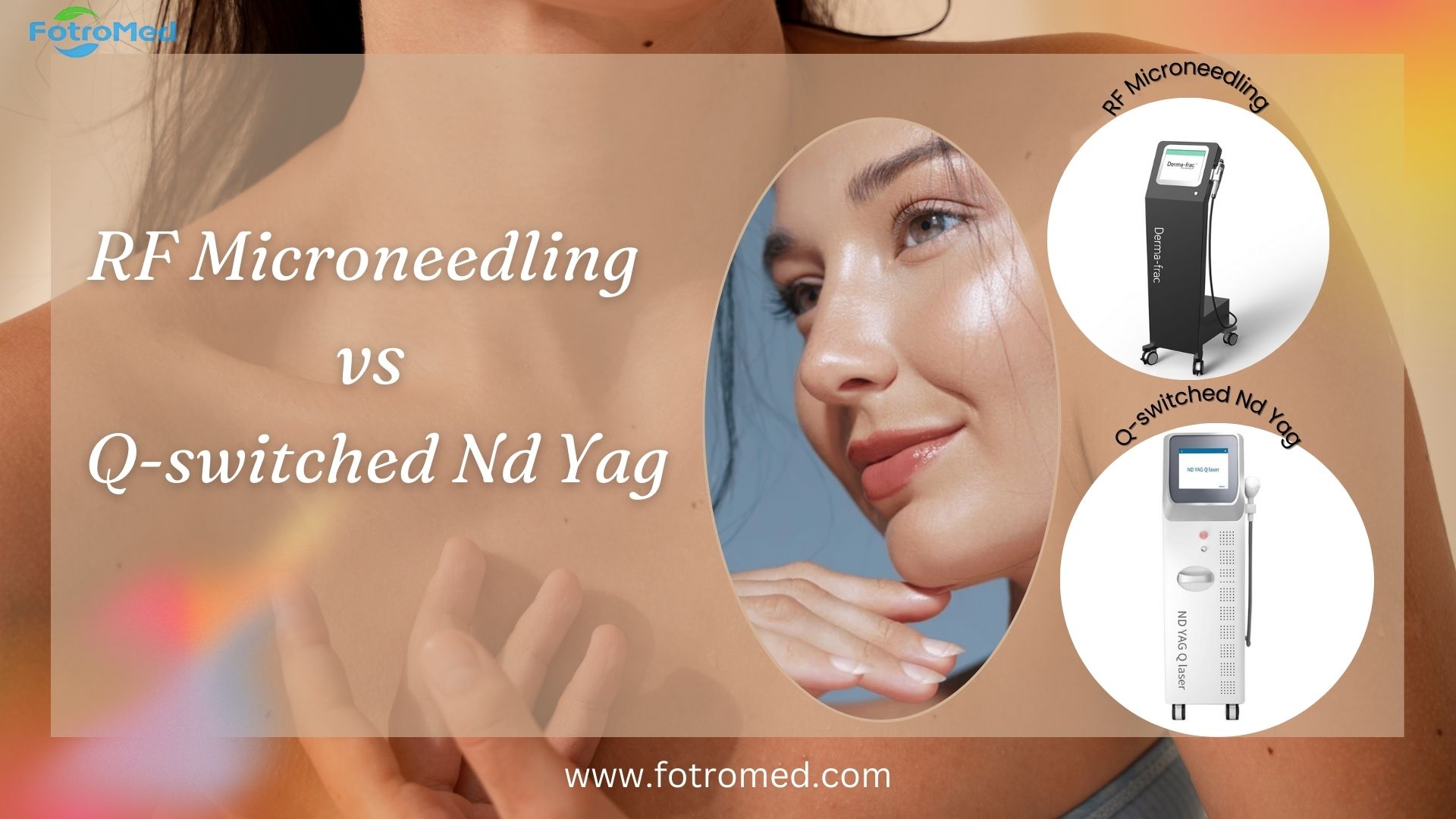 RF Microneedling vs Q-switched Nd Yag - Fotromed