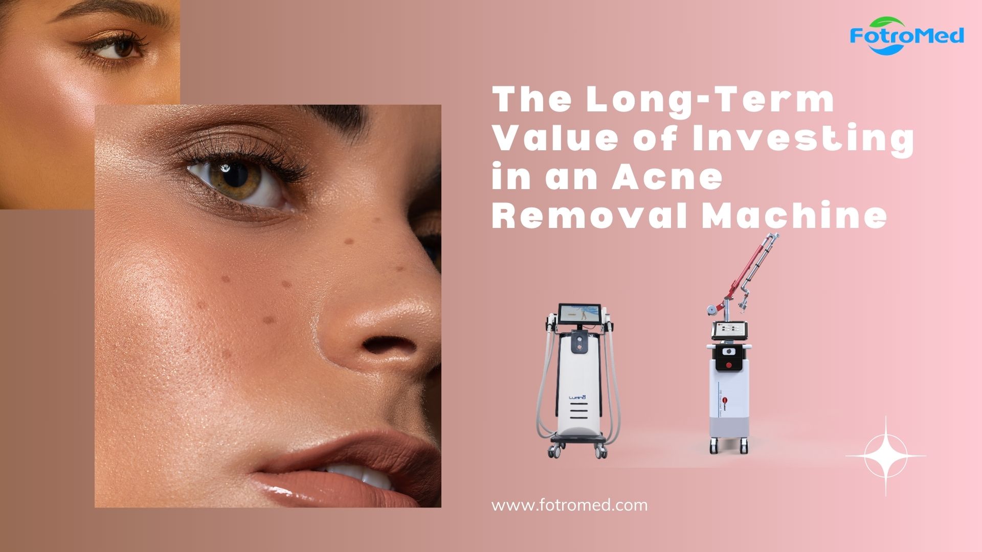 The Long-Term Value of Investing in an Acne Removal Machine - Fotromed