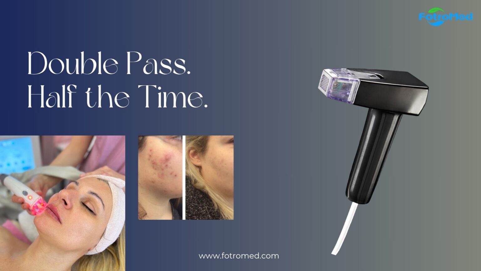 Double Pass RF Treatments | Cut Session Time & Boost Clinic ROI with ...